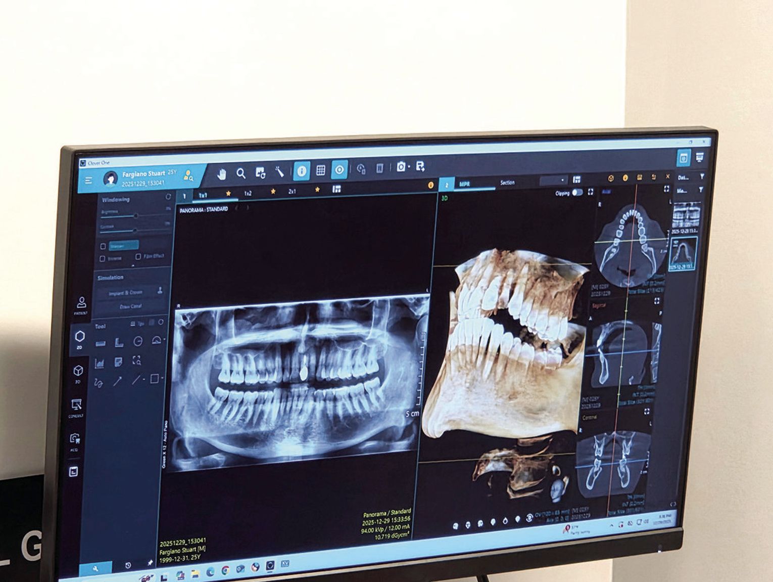 New Dental Imaging Comes To RAHC